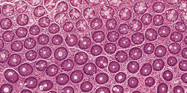 Scientists use machine-learning algorithms to map out 10 billion cells ...